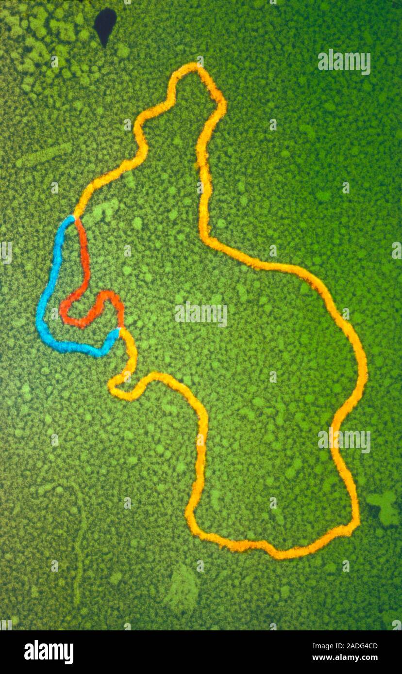 Hand-tinted transmission electron micrograph (TEM) of a circular loop ...