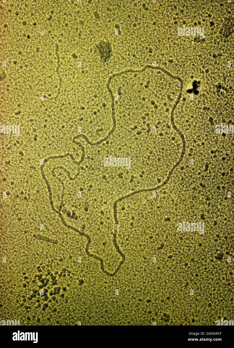 Transmission electron micrograph of a circular loop or plasmid of ...