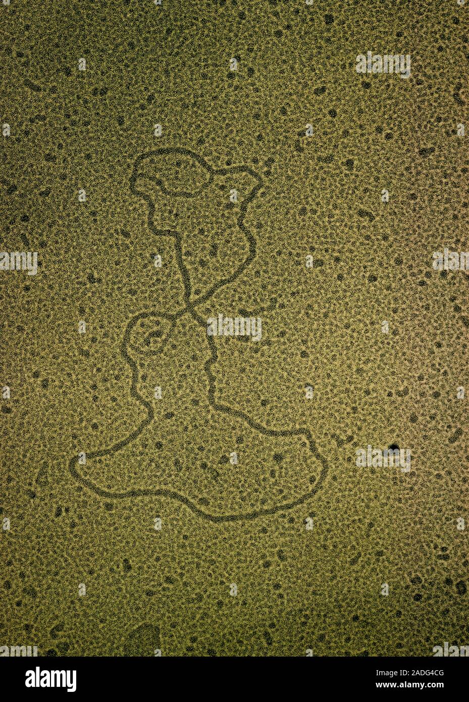 Transmission electron micrograph (TEM) of a circular loop or plasmid ...