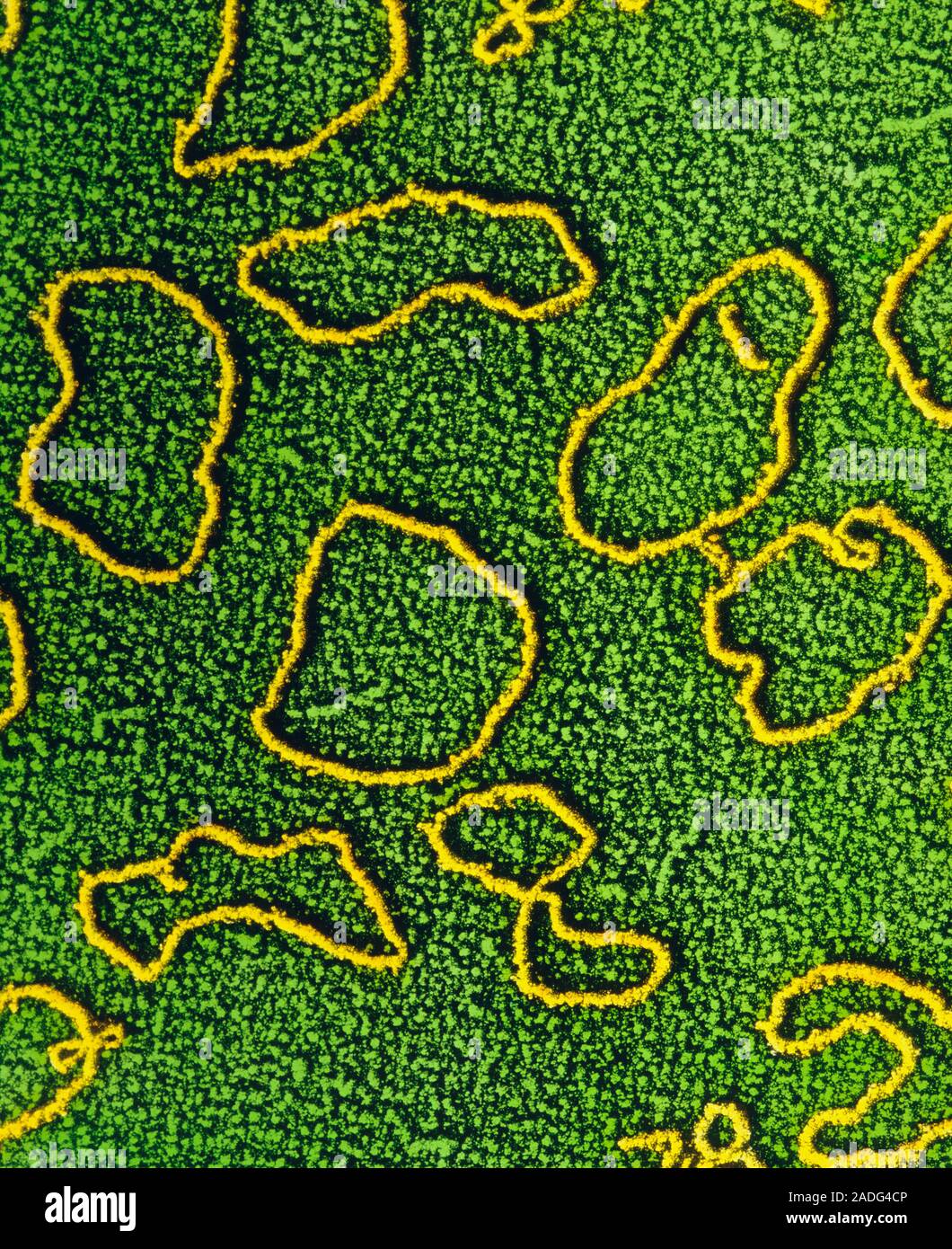 False Colour Transmission Electron Micrograph Of Plasmids Of Bacterial Dna From The Bacterium
