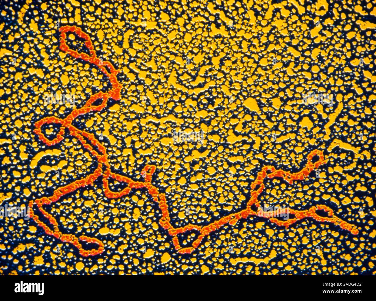 False colour transmission electron micrograph (TEM) of circular DNA ...