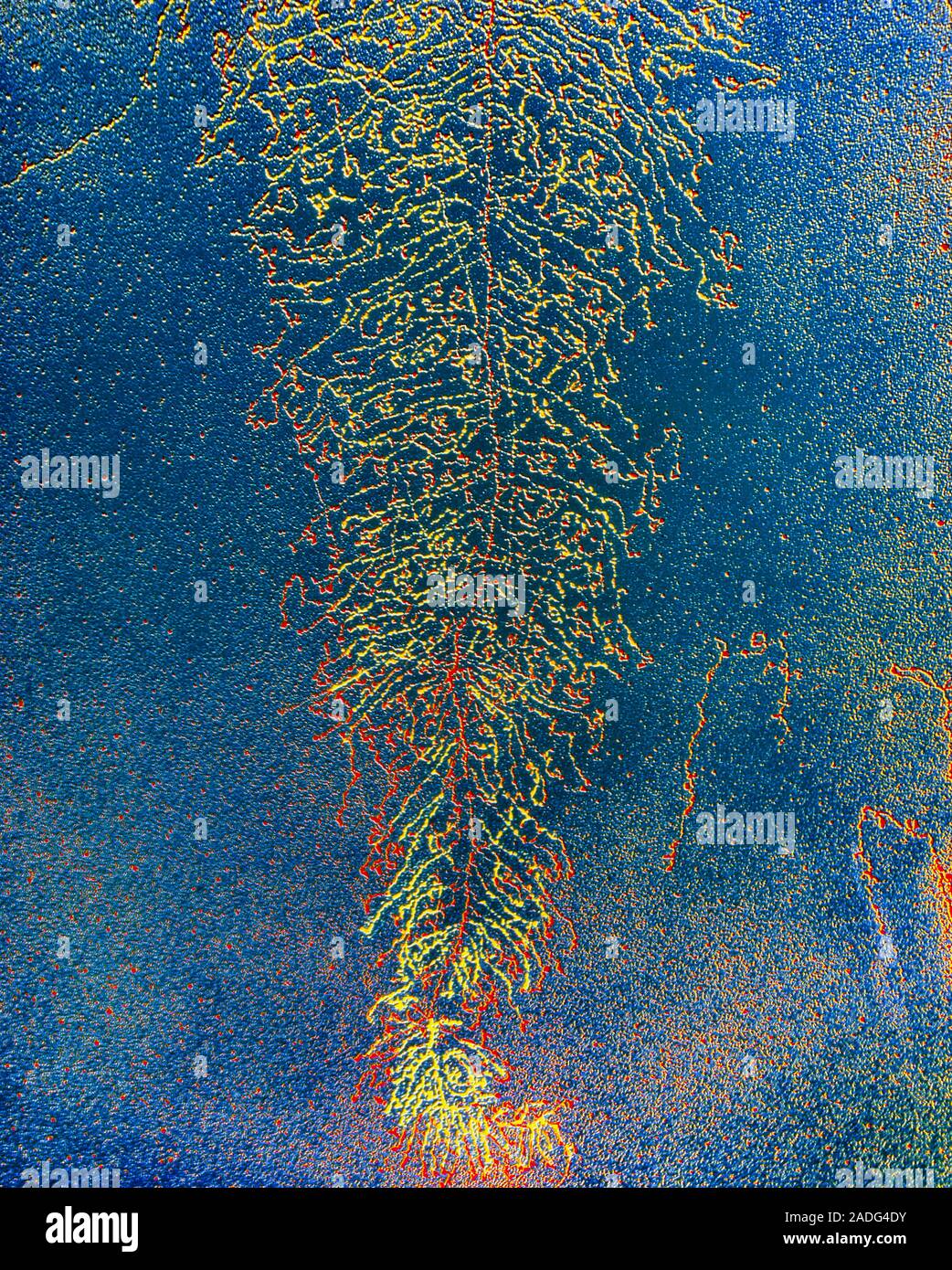 DNA transcription by mRNA. Coloured transmission electron micrograph of ...