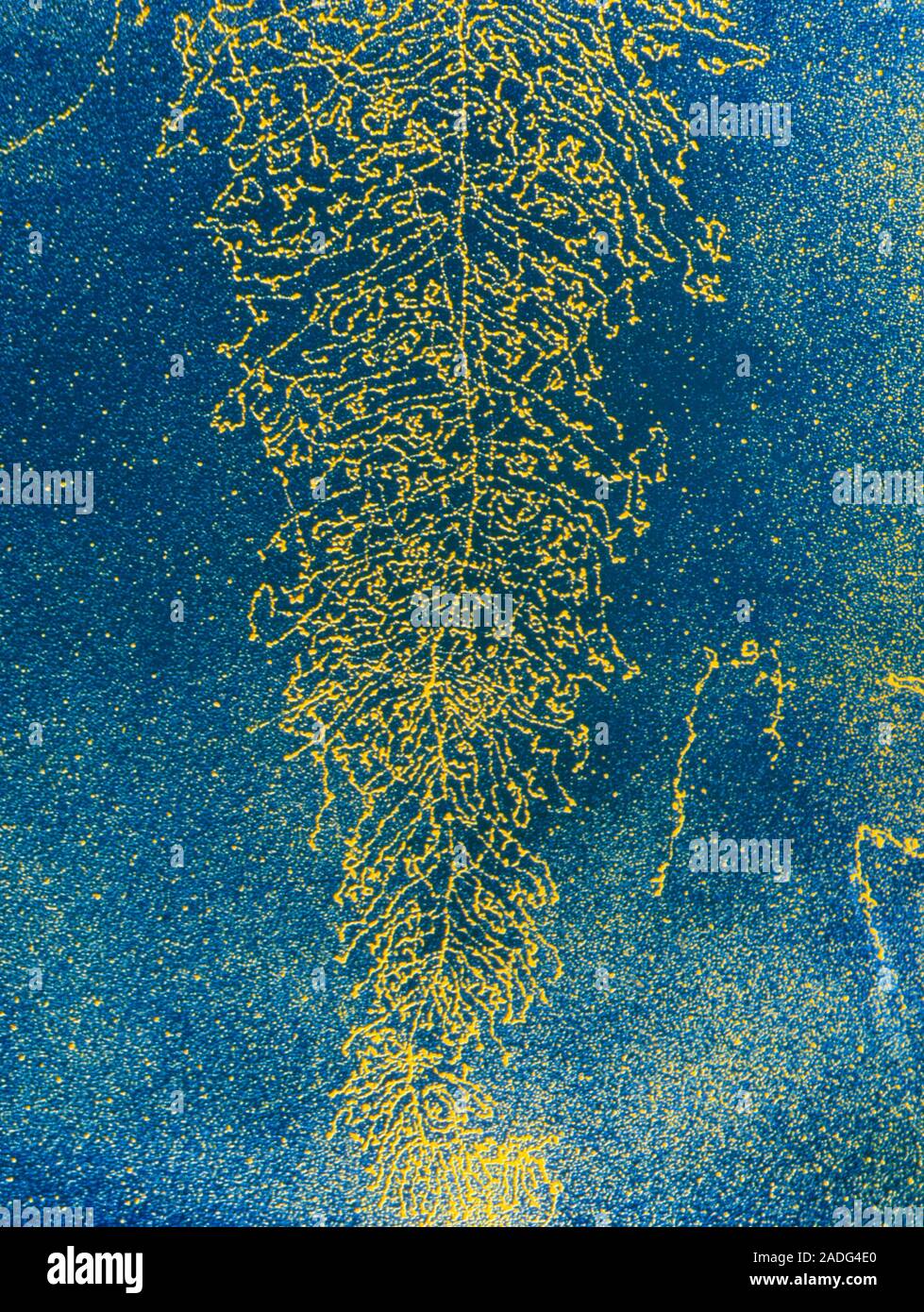 DNA transcription by mRNA. Coloured transmission electron micrograph of ...