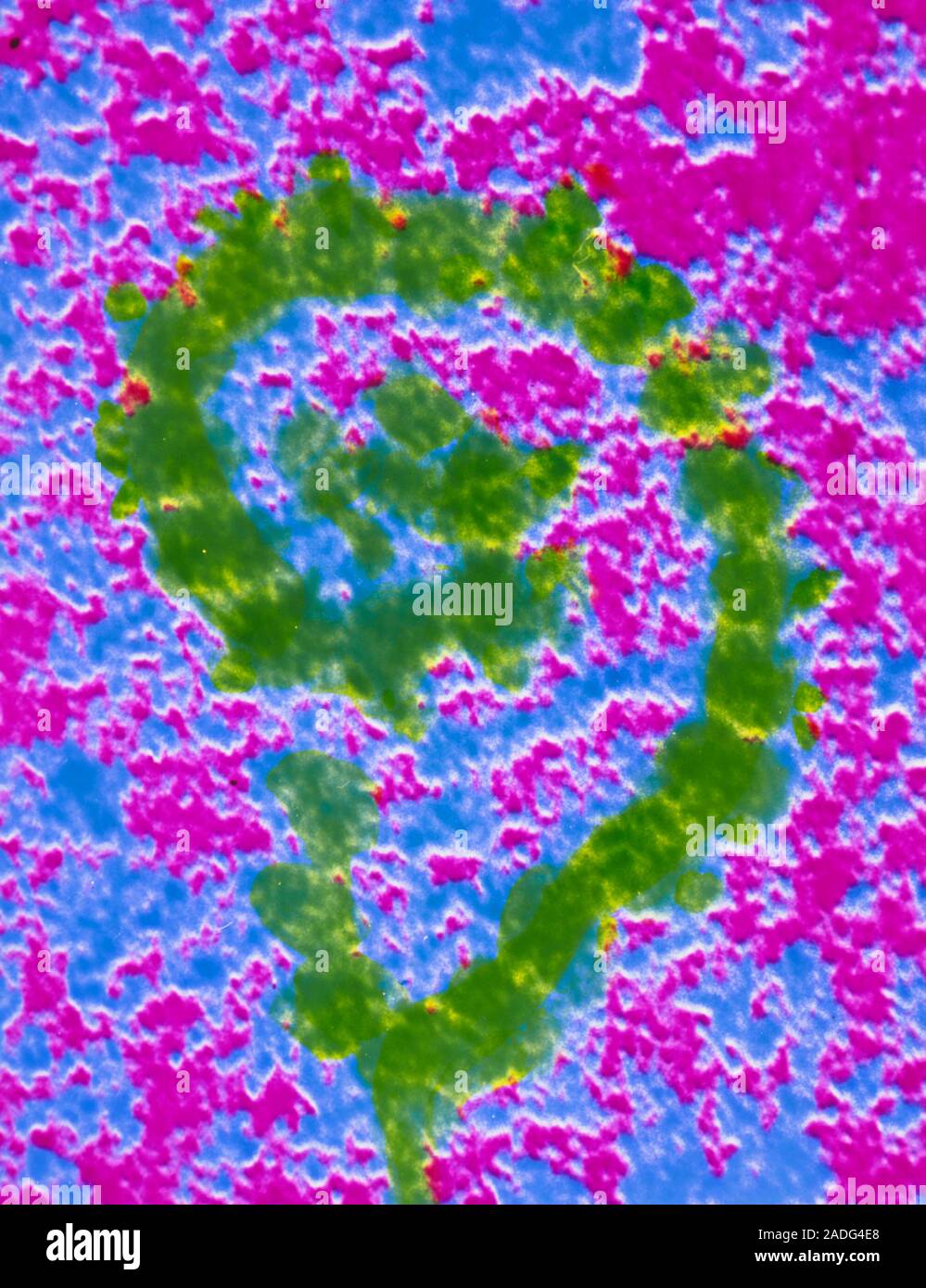 Transmission electron micrograph (TEM) of a polyribosome from a human ...