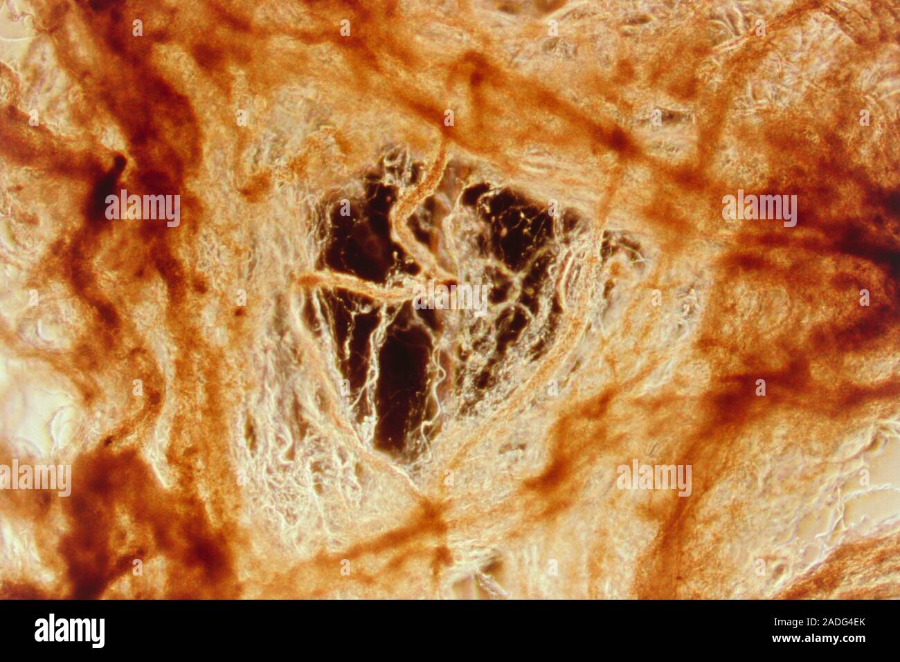 Light micrograph of human DNA. The DNA strands of various length have ...