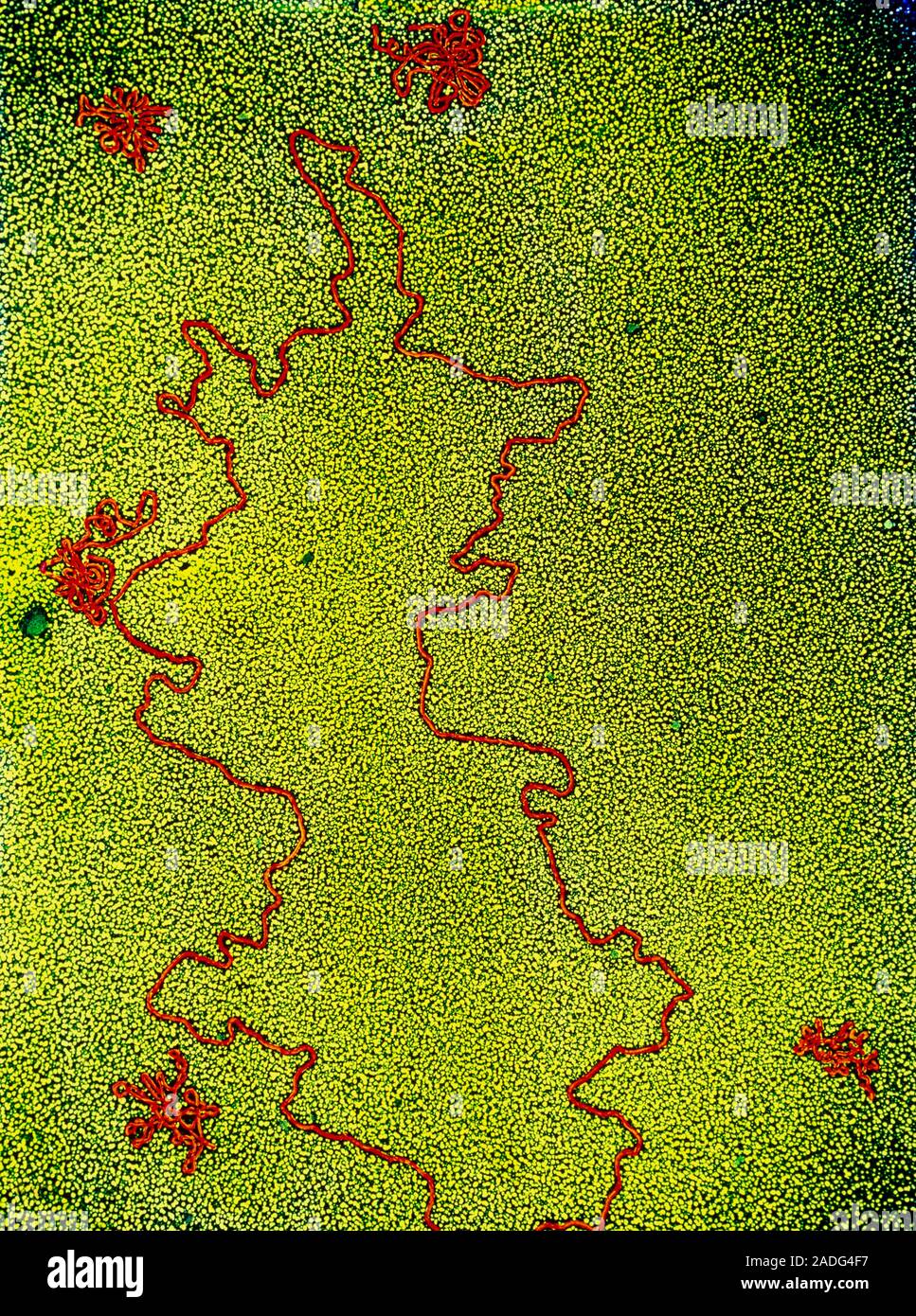 Resistance to antibiotics: false-colour transmission electron ...