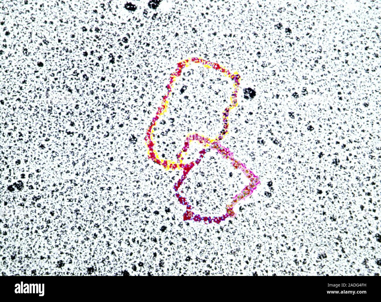 Bacterial Plasmids Coloured Transmission Electron Micrograph Tem Of Two Circles Or Plasmids
