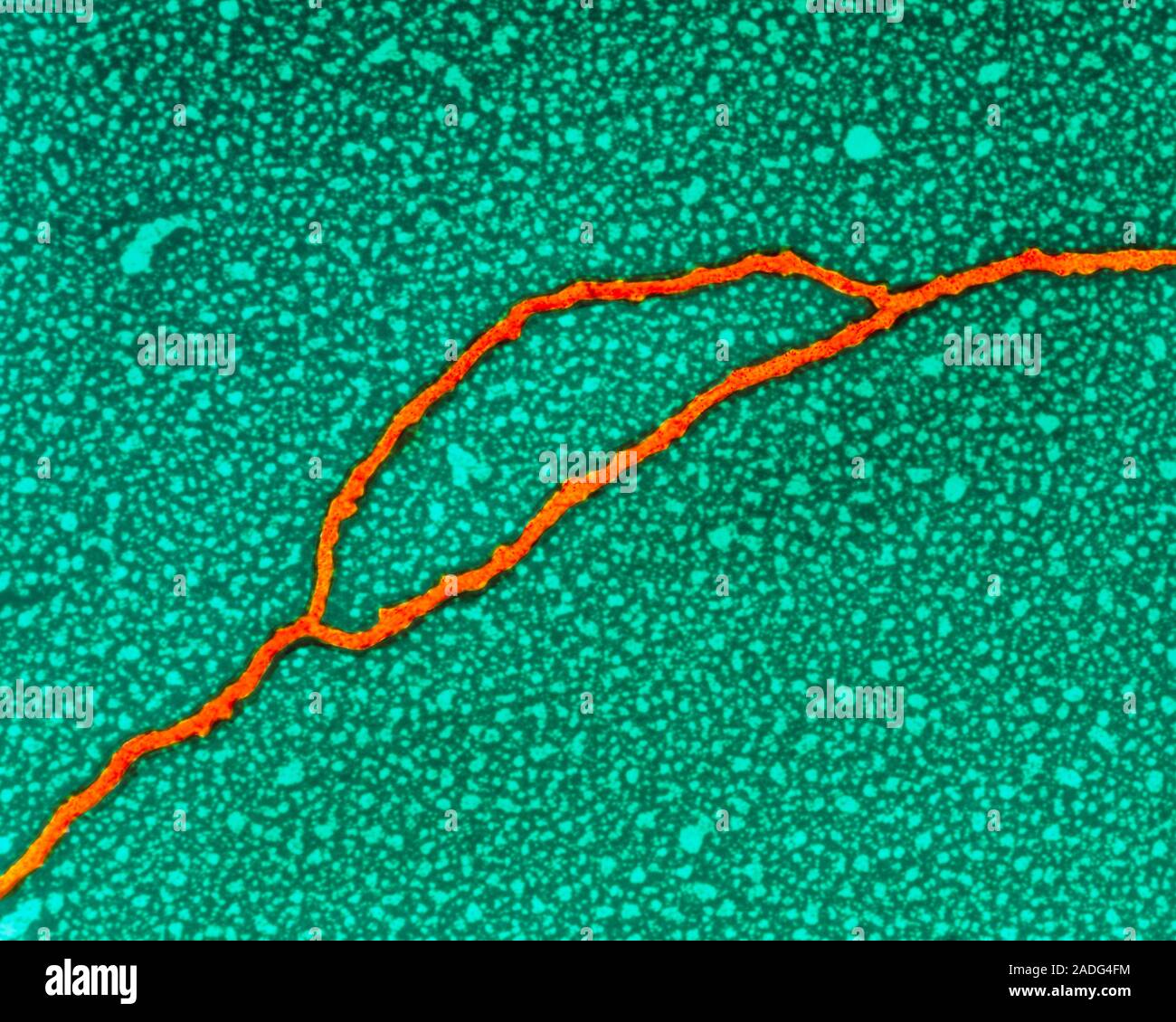 DNA replication. Coloured Transmission Electron Micrograph (TEM) of ...