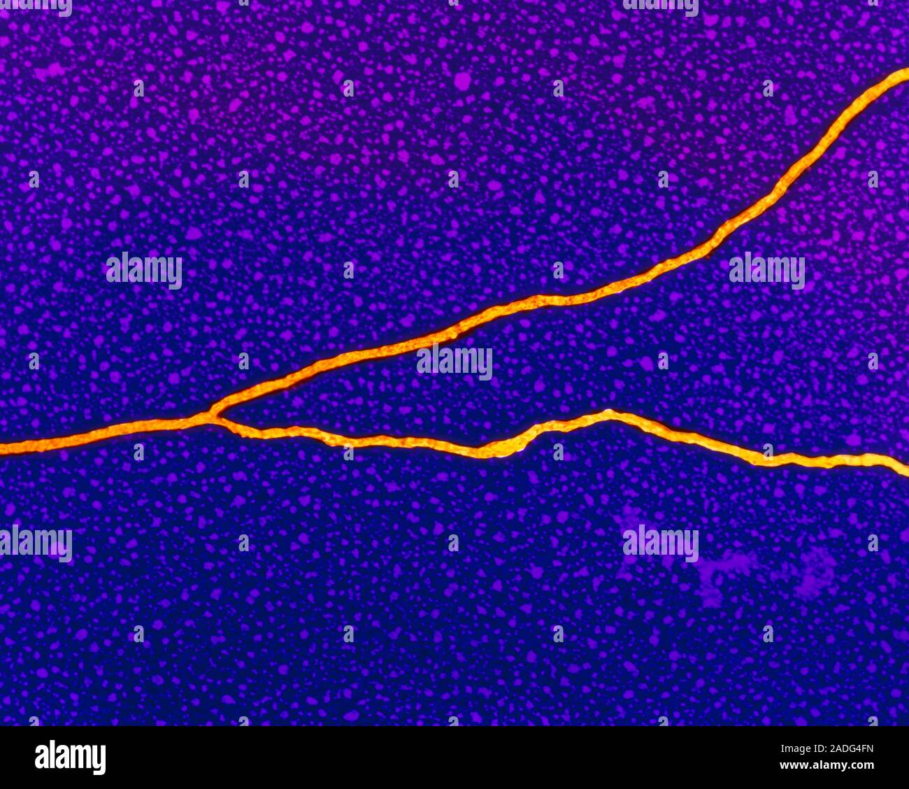 DNA replication. Coloured Transmission Electron Micrograph (TEM) of ...