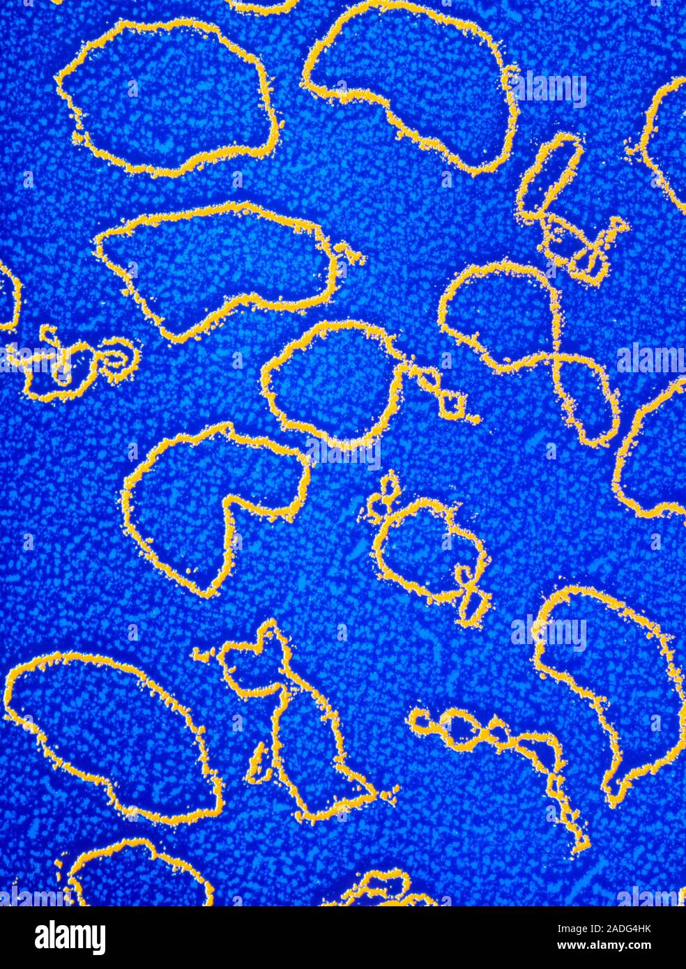DNA plasmids. Coloured Transmission Electron Micrograph (TEM) of ...