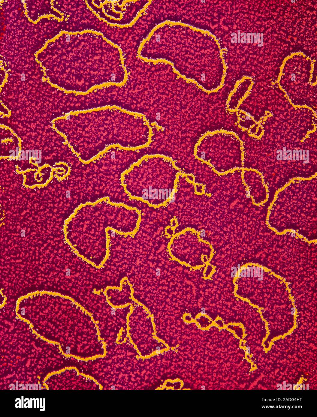 DNA plasmids. Coloured Transmission Electron Micrograph (TEM) of ...