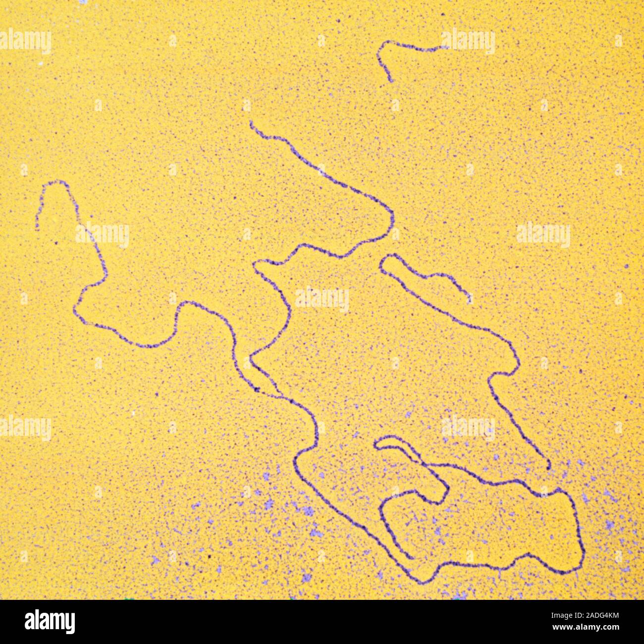DNA replication. Coloured transmission electron micrograph (TEM) of ...