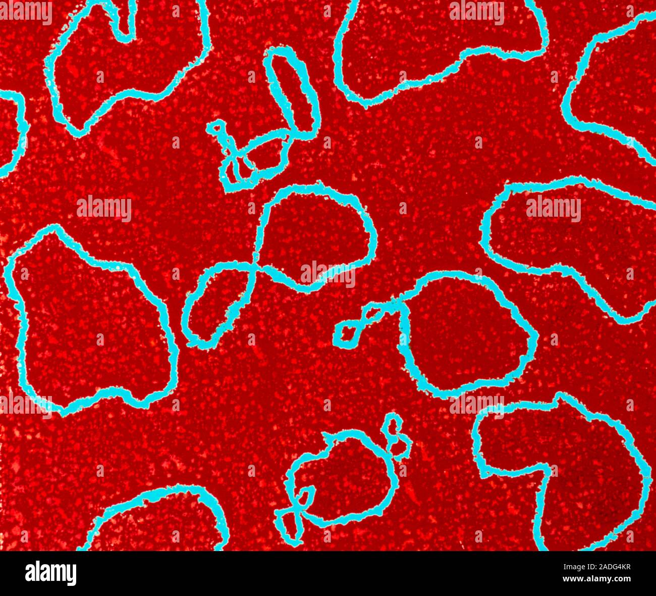 DNA plasmids. Coloured transmission electron micrograph of DNA plasmids ...