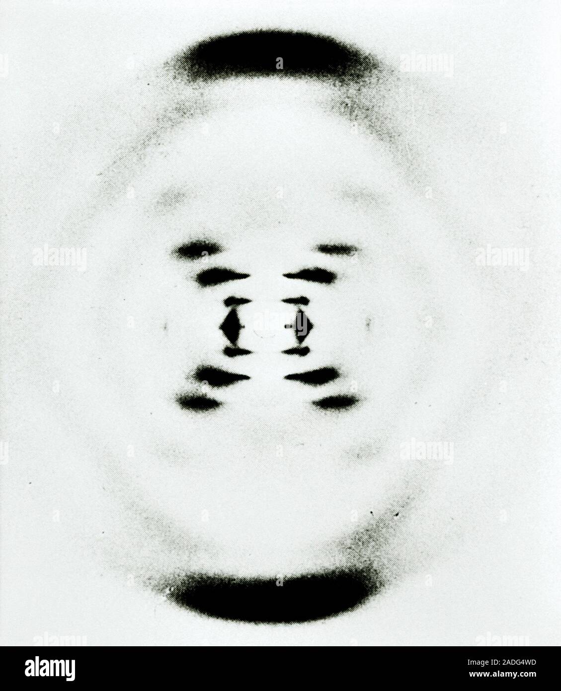 DNA. X-ray diffraction photograph of DNA (deoxyribonucleic acid). This ...