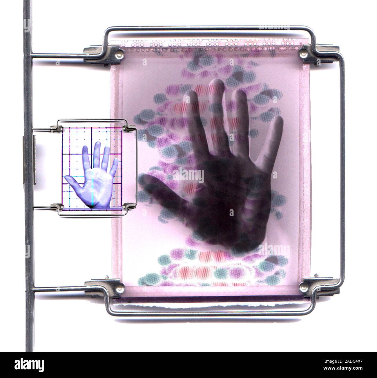 DNA fingerprinting. Conceptual image of a human hand and a strand of ...