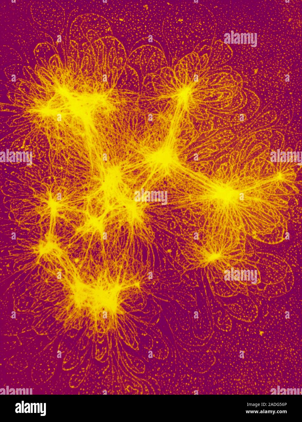 E. coli DNA. Coloured transmission electron micrograph (TEM) of a ...