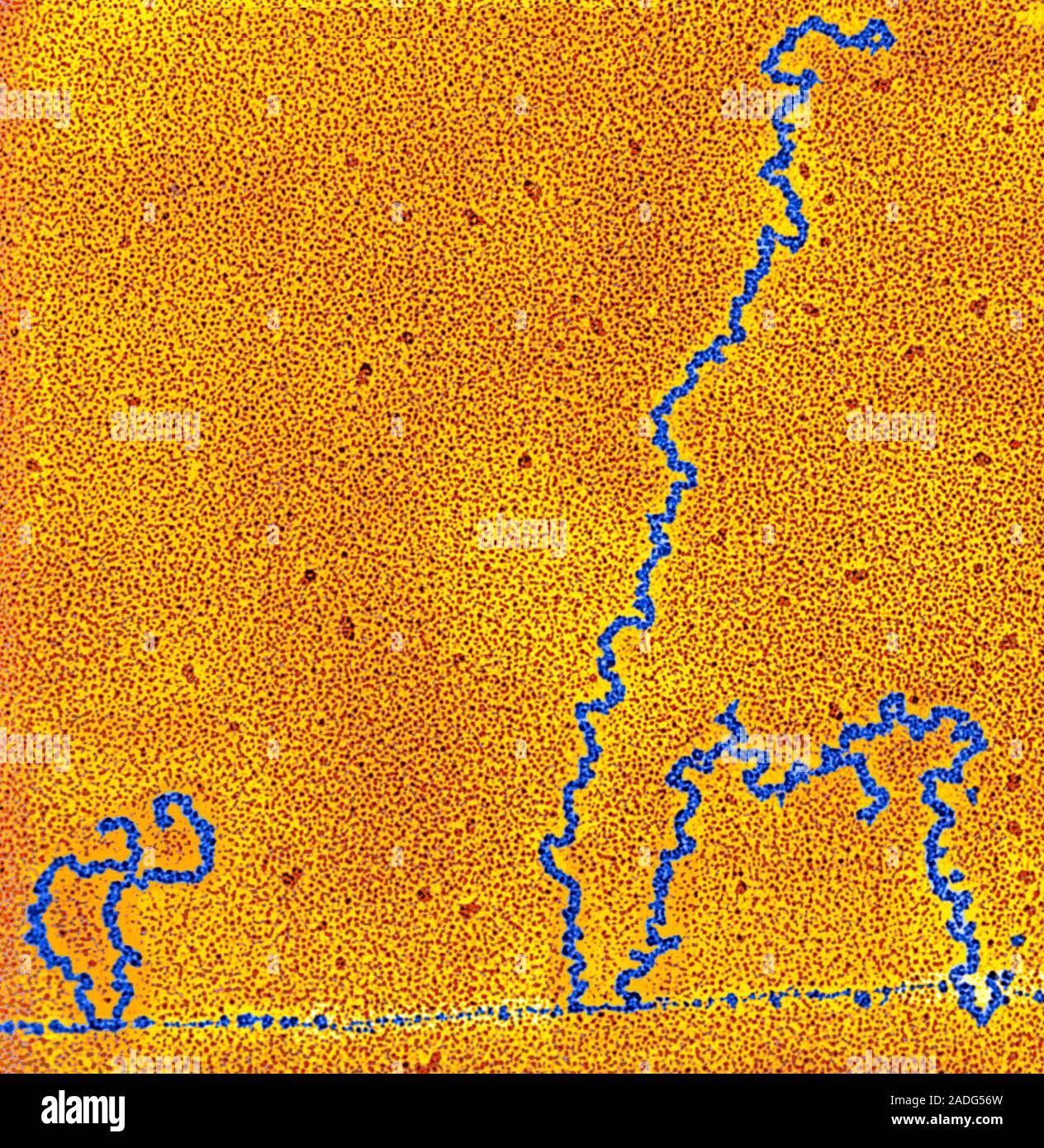 Transcription in E. coli. Coloured transmission electron micrograph of ...