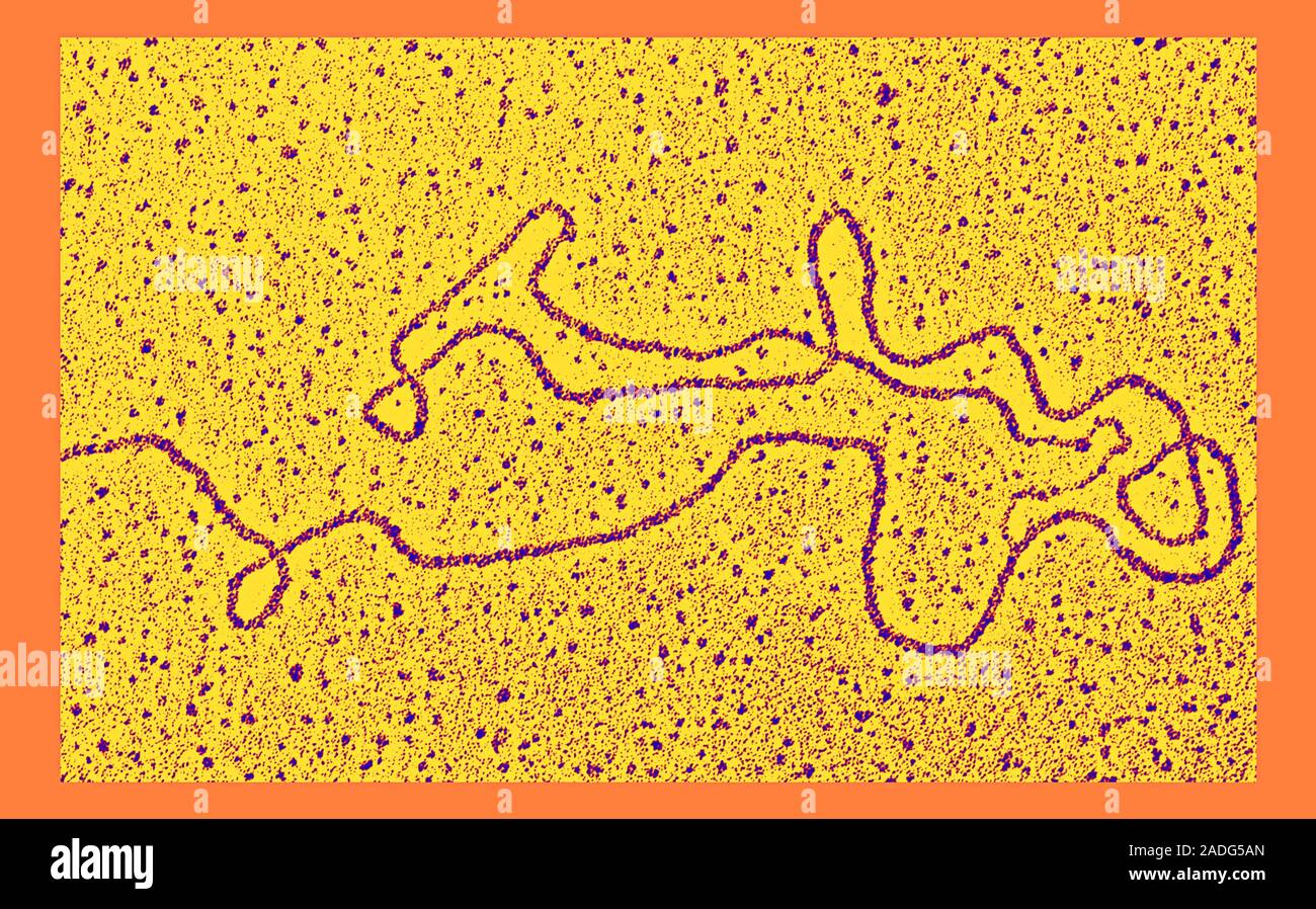 DNA strand telomere. Coloured transmission electron micrograph (TEM) of ...