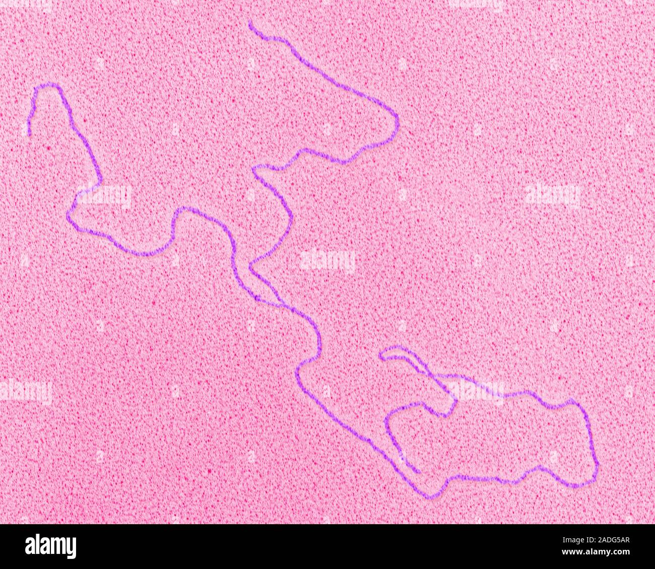 DNA replication. Coloured transmission electron micrograph (TEM) of a ...