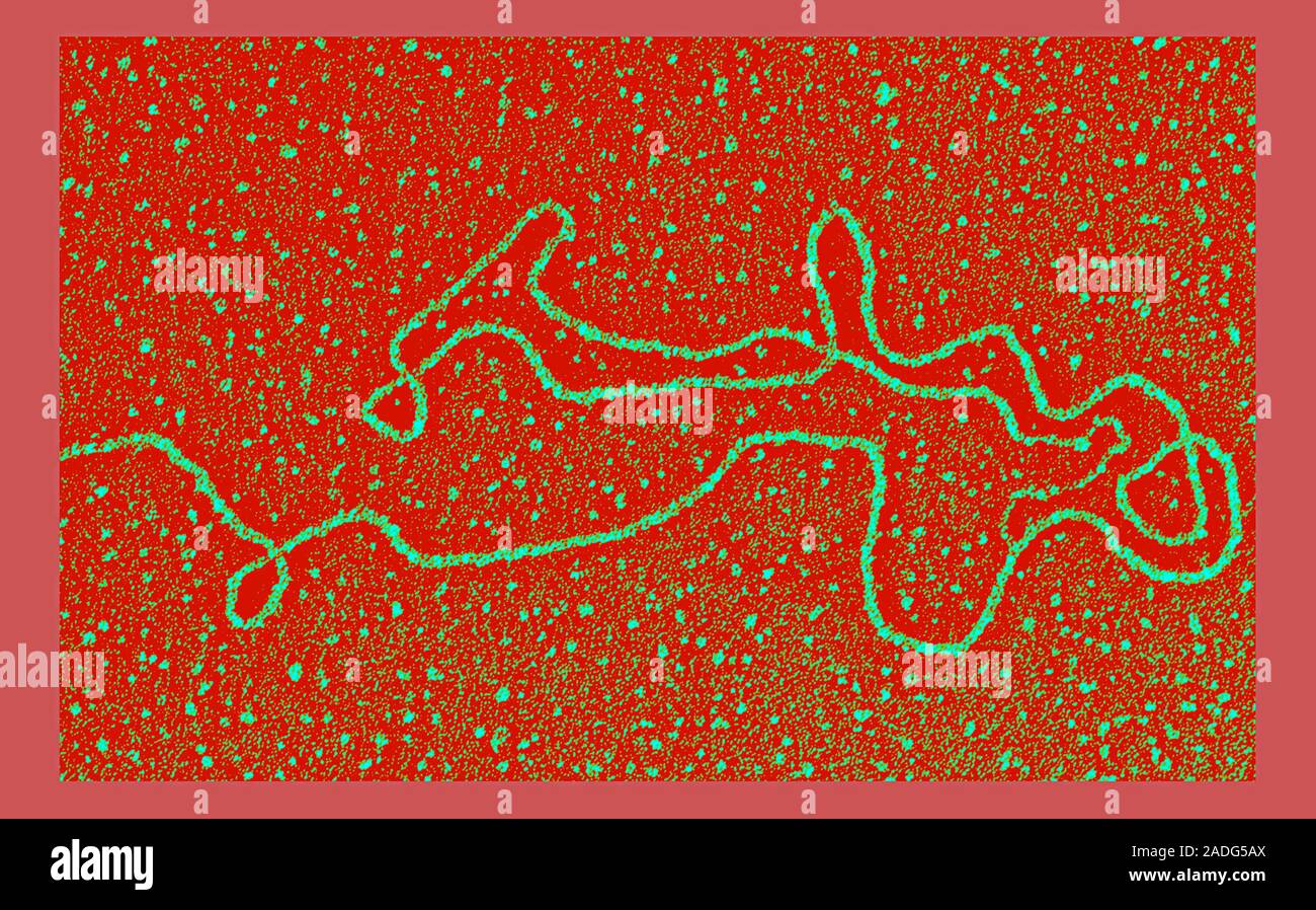 DNA strand telomere. Coloured transmission electron micrograph (TEM) of ...