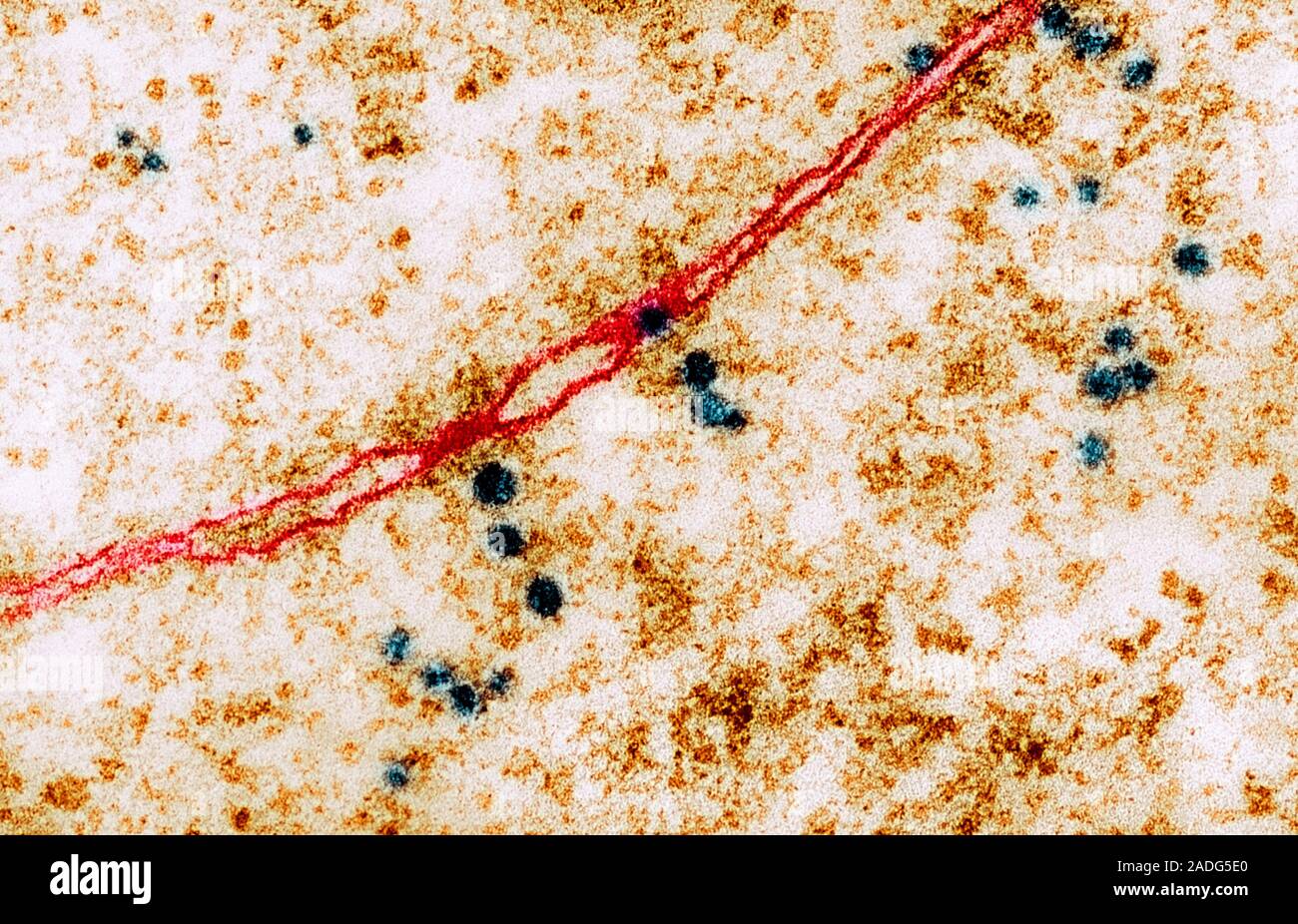 Ribosomes. Coloured transmission electron micrograph (TEM) of ribosomes ...