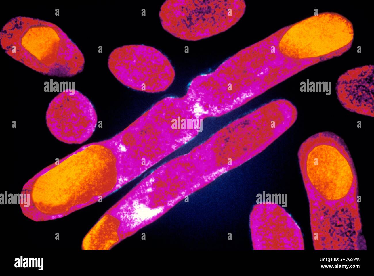 Genetically-altered bacteria. Coloured Transmission Electron Micrograph ...