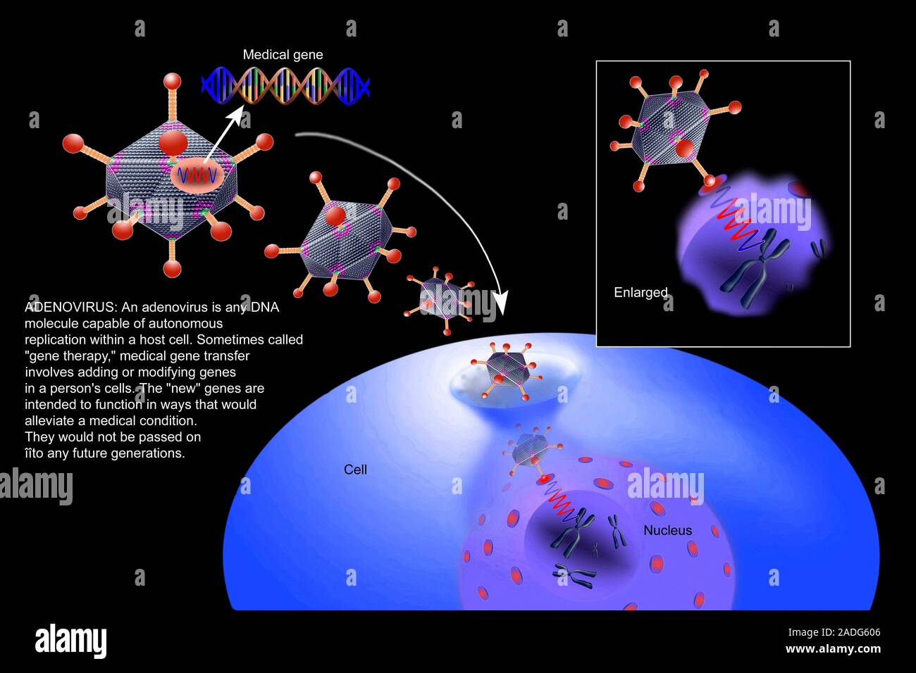 Viral gene therapy. Diagram of an adenovirus (upper left) being used to ...