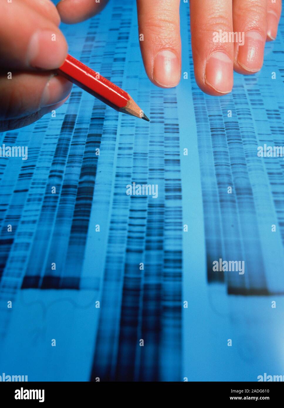 Scientist examining DNA sequencing autoradiogram on a light box. Each ...