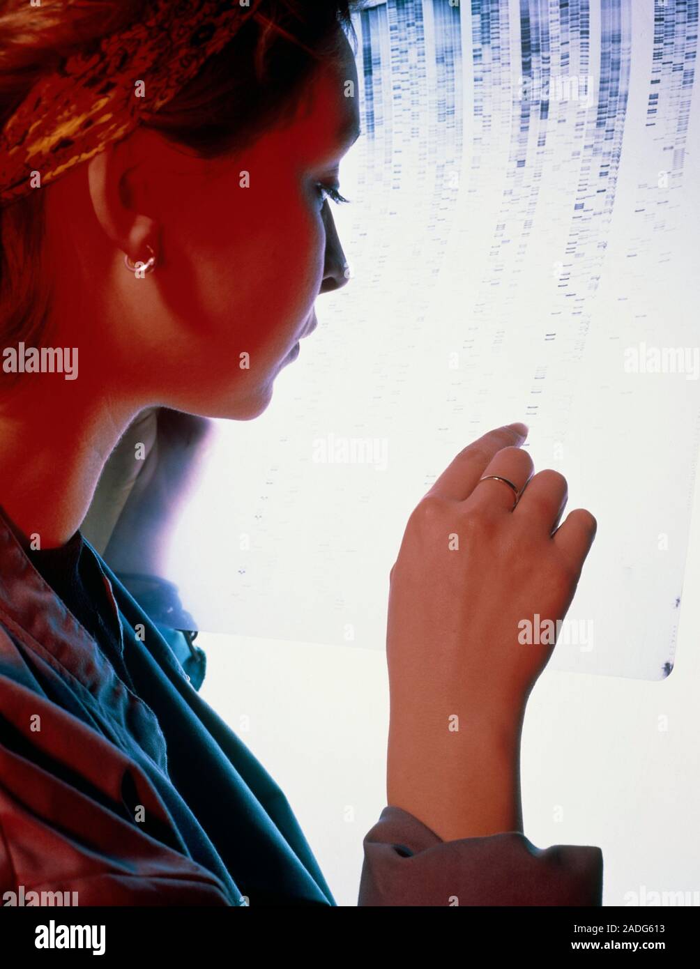 Scientist examining DNA sequencing autoradiogram against a light box ...