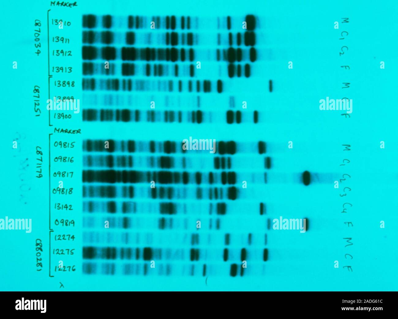 DNA fingerprinting used to analyse family relationships. The photo ...