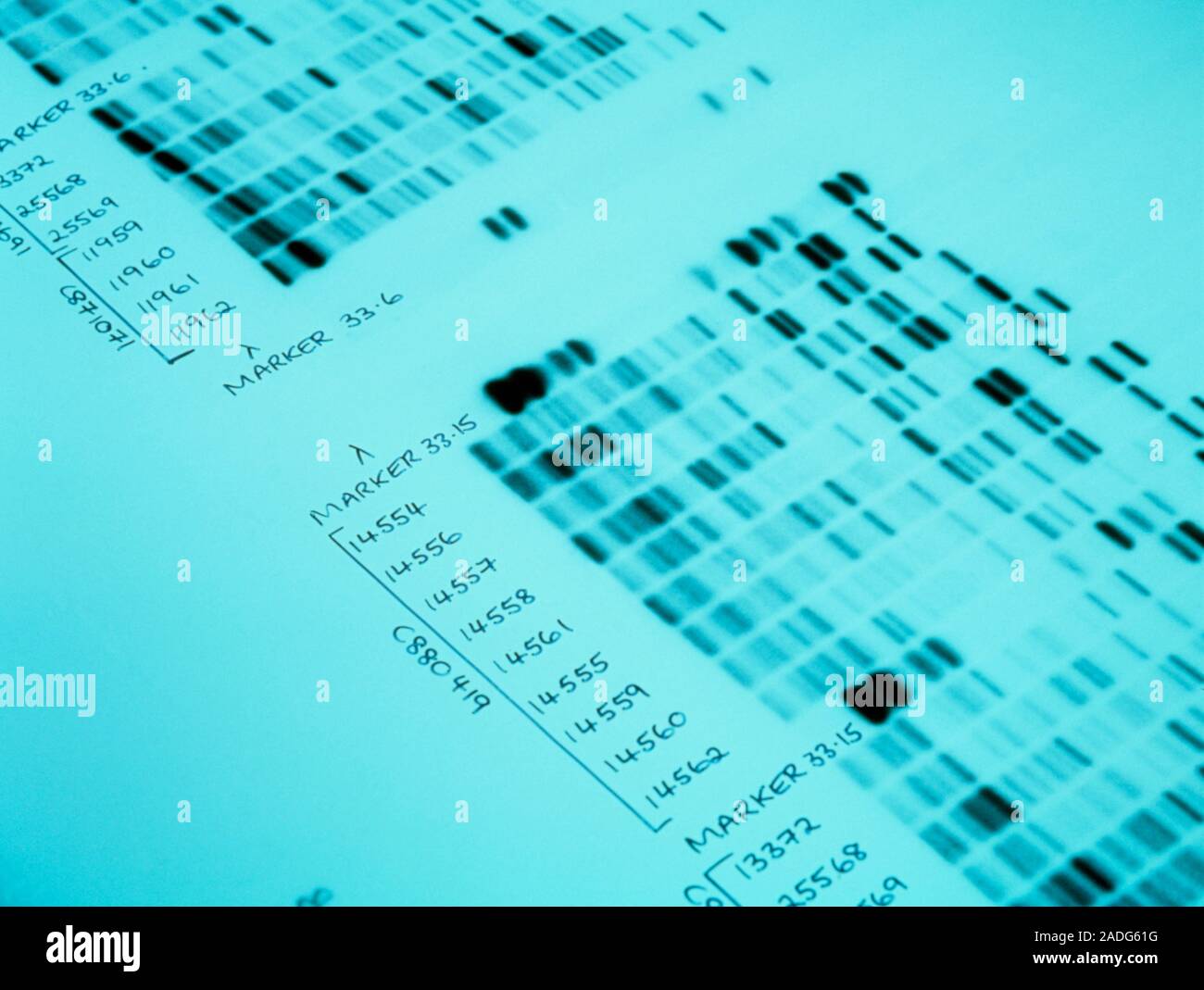 DNA fingerprints. The photo shows an X-ray (or autoradiograph) of bands ...