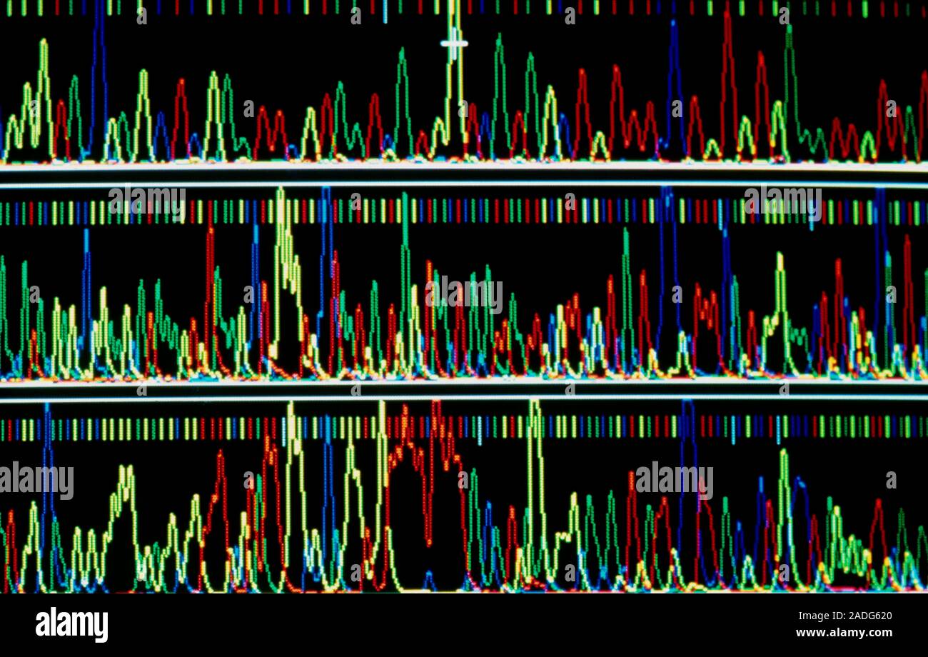 Mapping the human genome: computer analysis of the DNA sequence of the ...