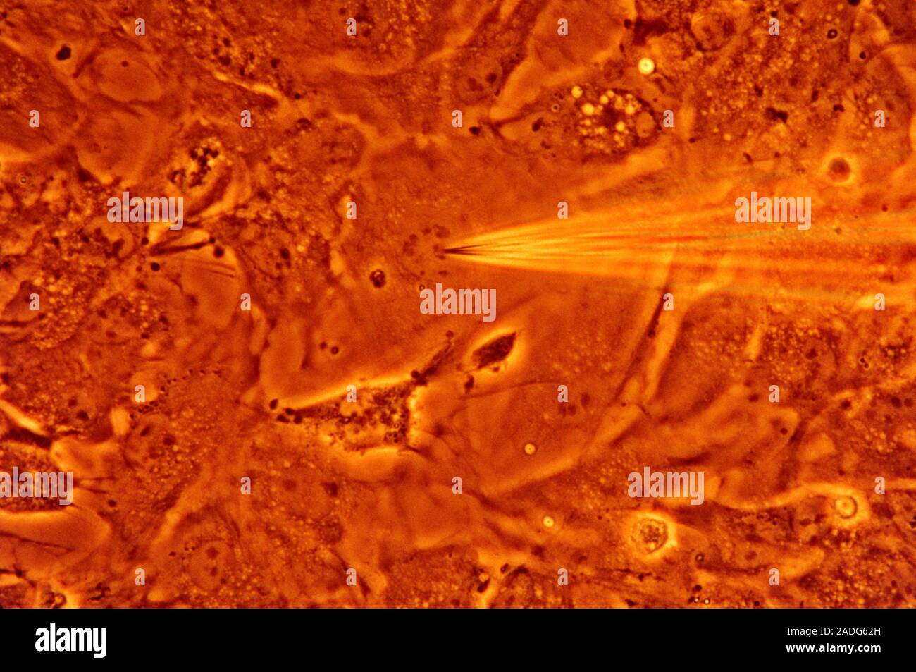 Cancer research: light micrograph showing the microinjection of a ...
