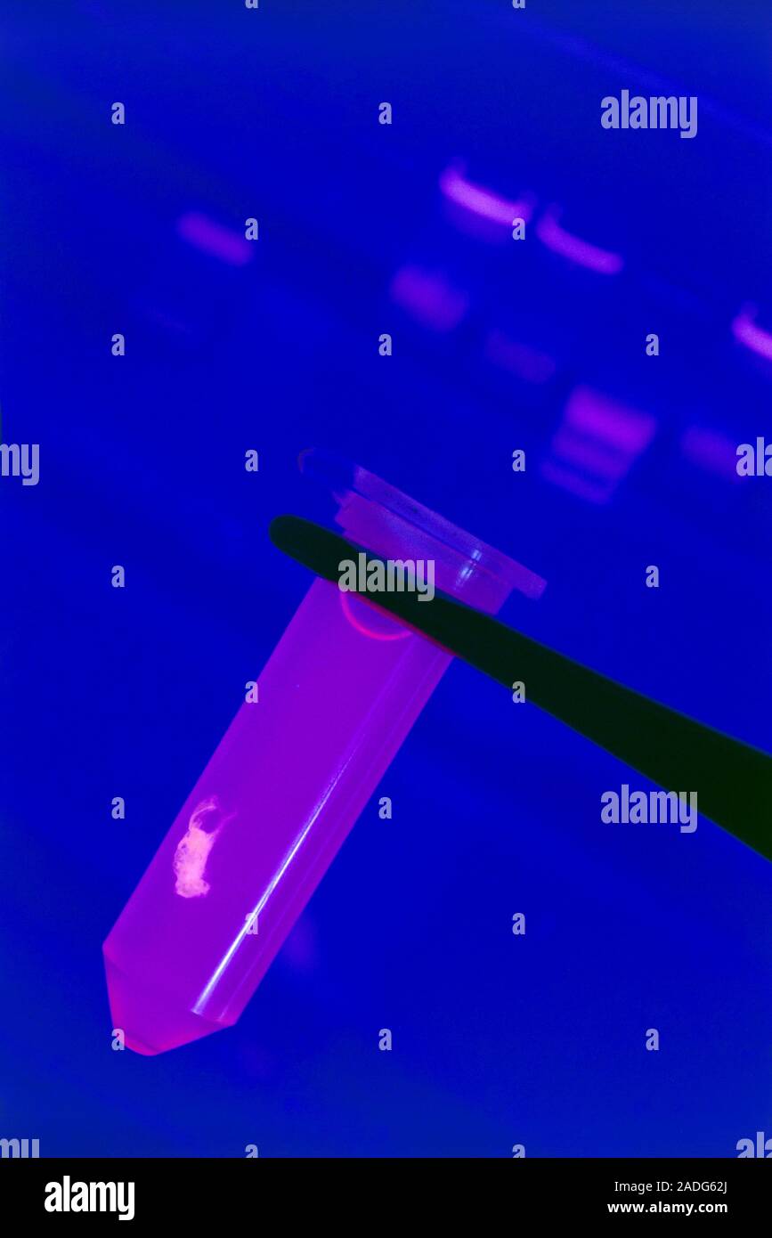 DNA fingerprinting. Sample tube containing pellet of human DNA (white ...