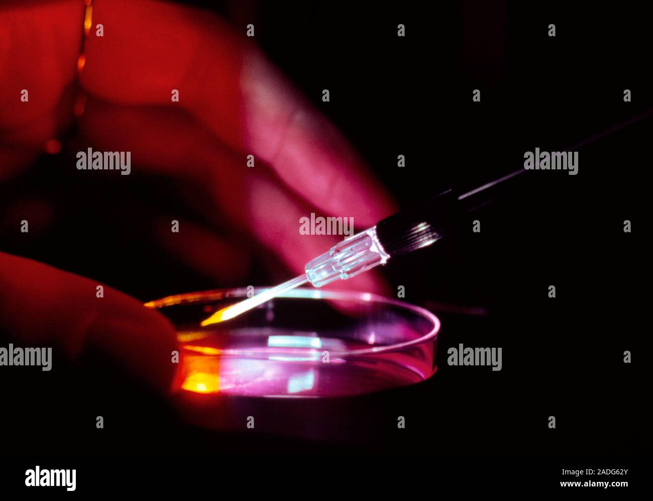 Gene therapy. DNA micro-injection technique, using a micropipette to ...