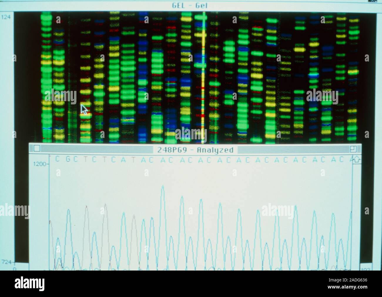 Human genome research: computer analysis of DNA sequencing ...