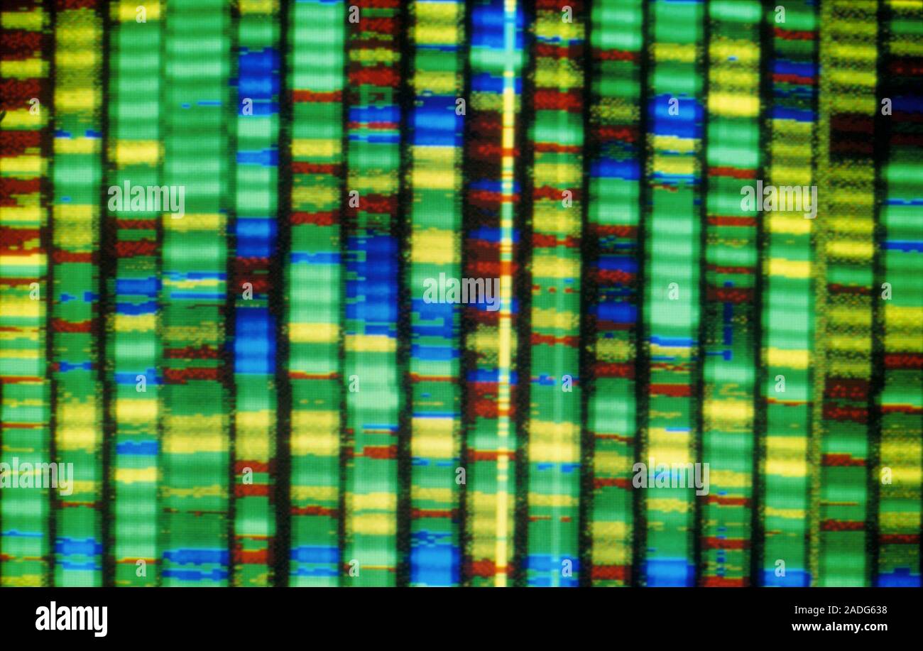 Human genome research: computer analysis of DNA sequencing ...