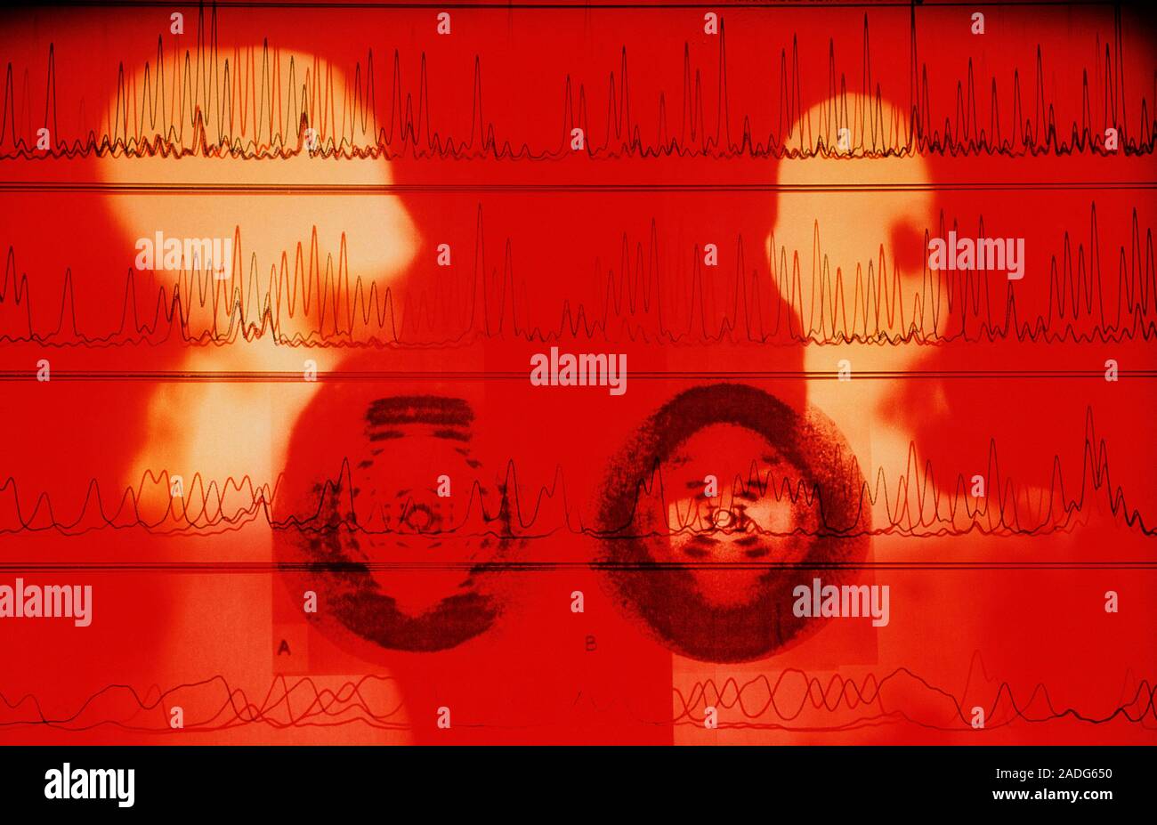 Discovery of the structure of DNA. Photograph illustrating the ...