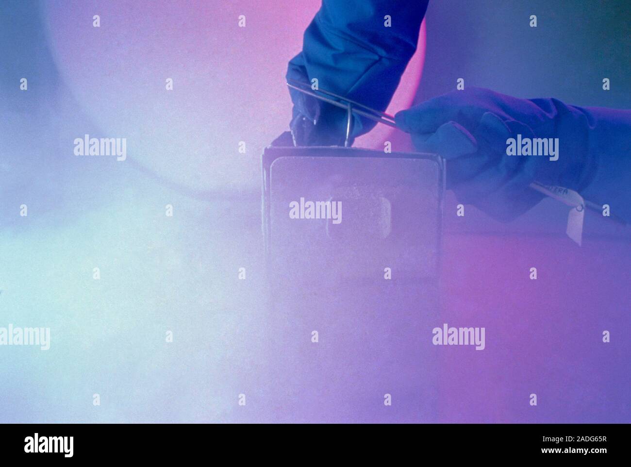 Cryogenic storage of human tissue. Gloved hands store human tissue in ...