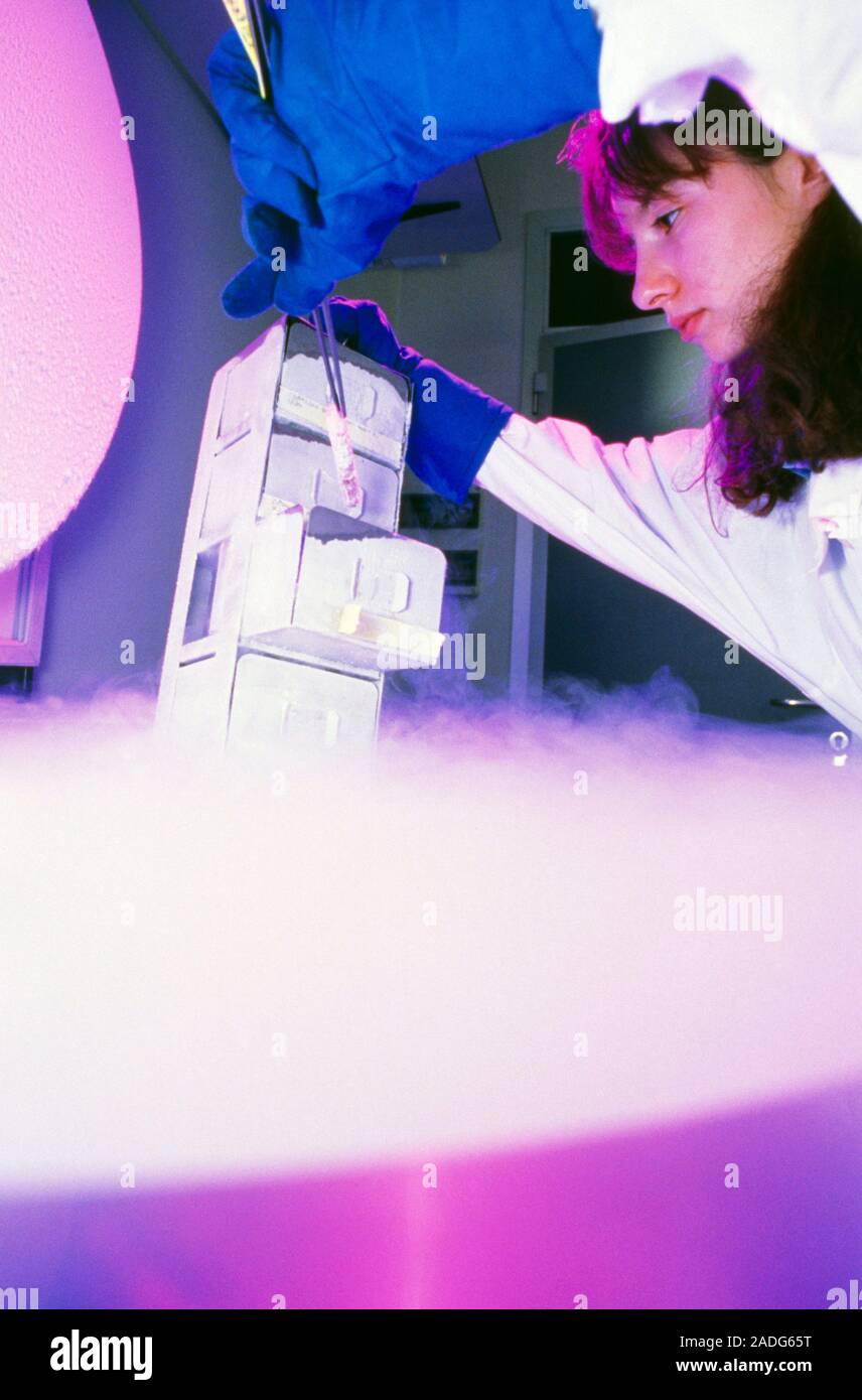 Cryogenic storage of human tissue. Researcher removes a human tissue ...