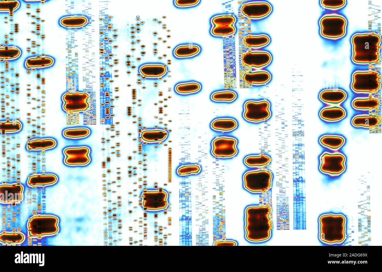 DNA sequences. Computer artwork of an autoradiogram of DNA ...