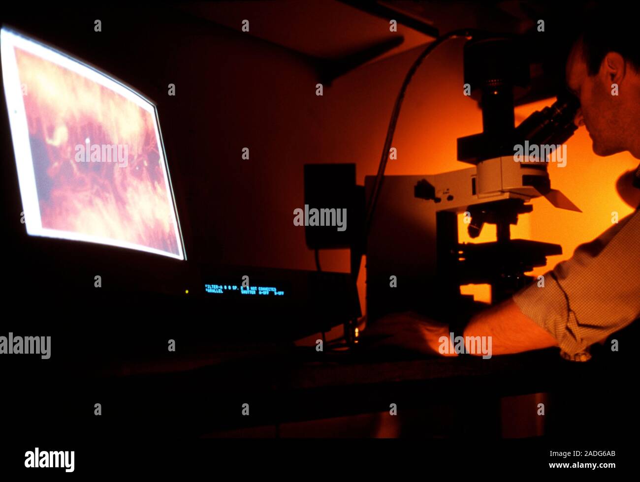 Genetic research. Geneticist studying a newt chromosome under an ...