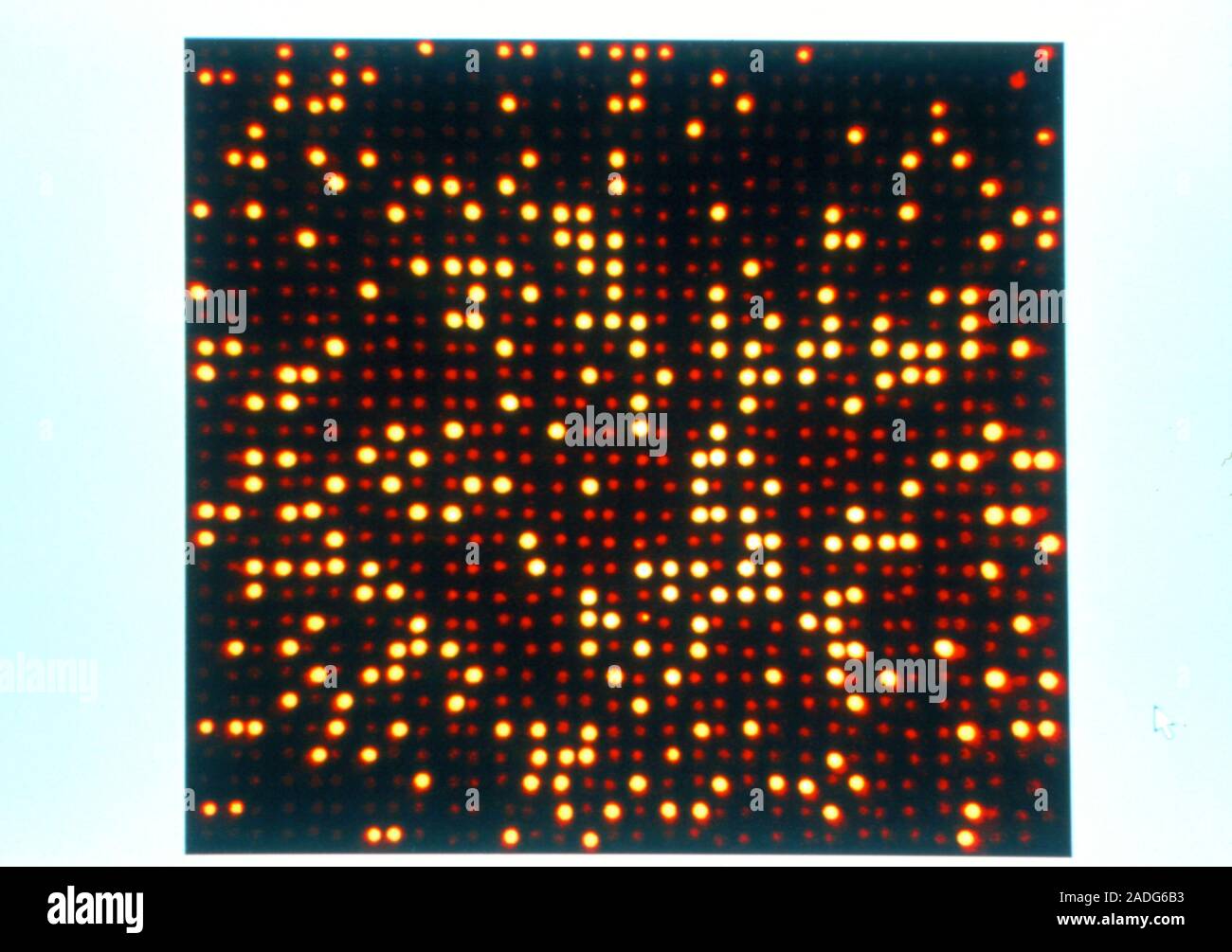 DNA BioChip. Results of a DNA analysis by a DNA BioChip, seen on a ...