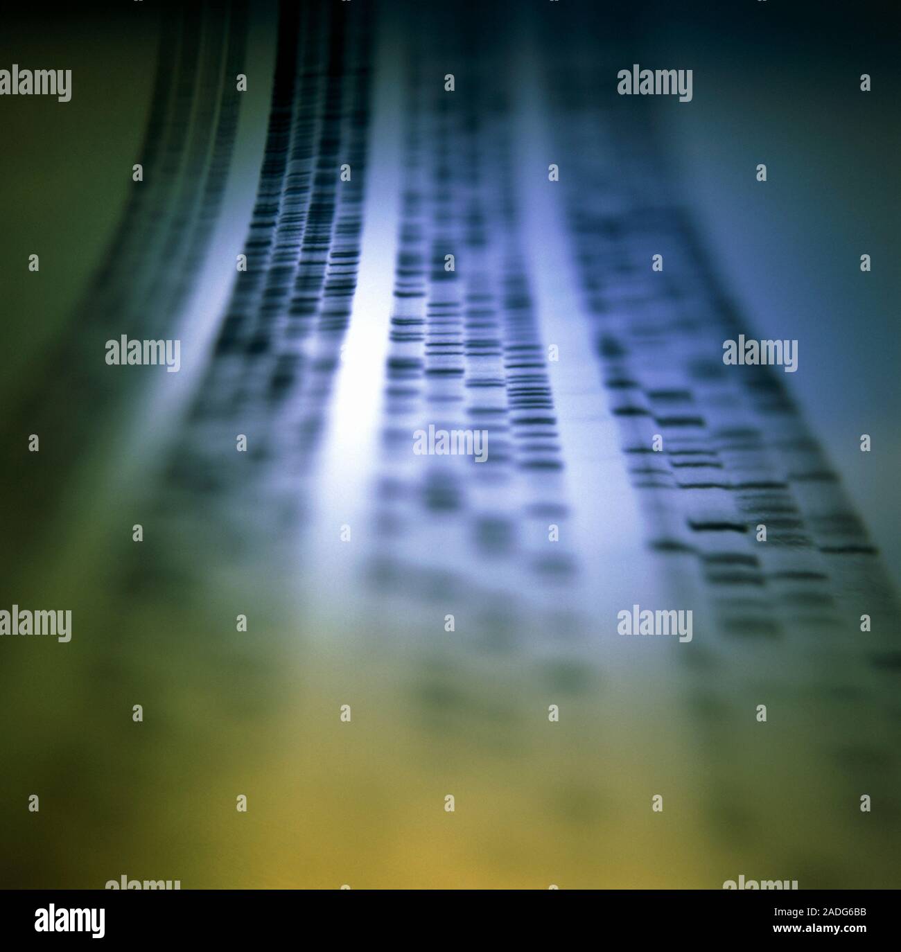 DNA fingerprint. View of an autoradiogram (X-ray) sheet showing DNA ...