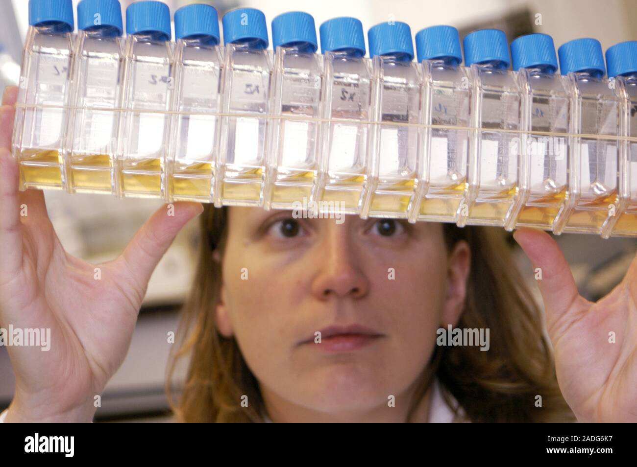 Genetic research. Geneticist examining stained cell samples from the ...