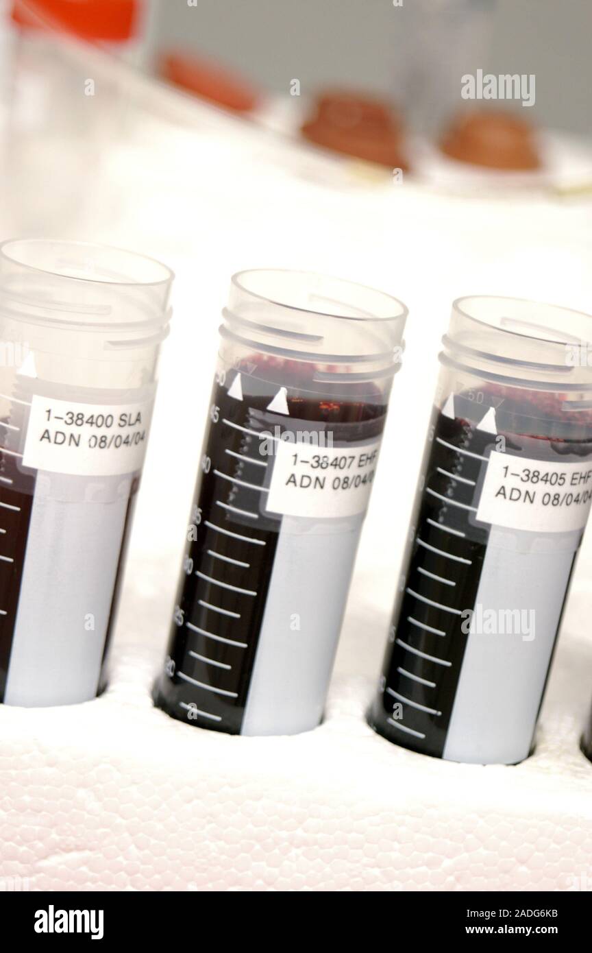 DNA extraction. Image 2 of 10. Lysis reaction of whole blood samples ...