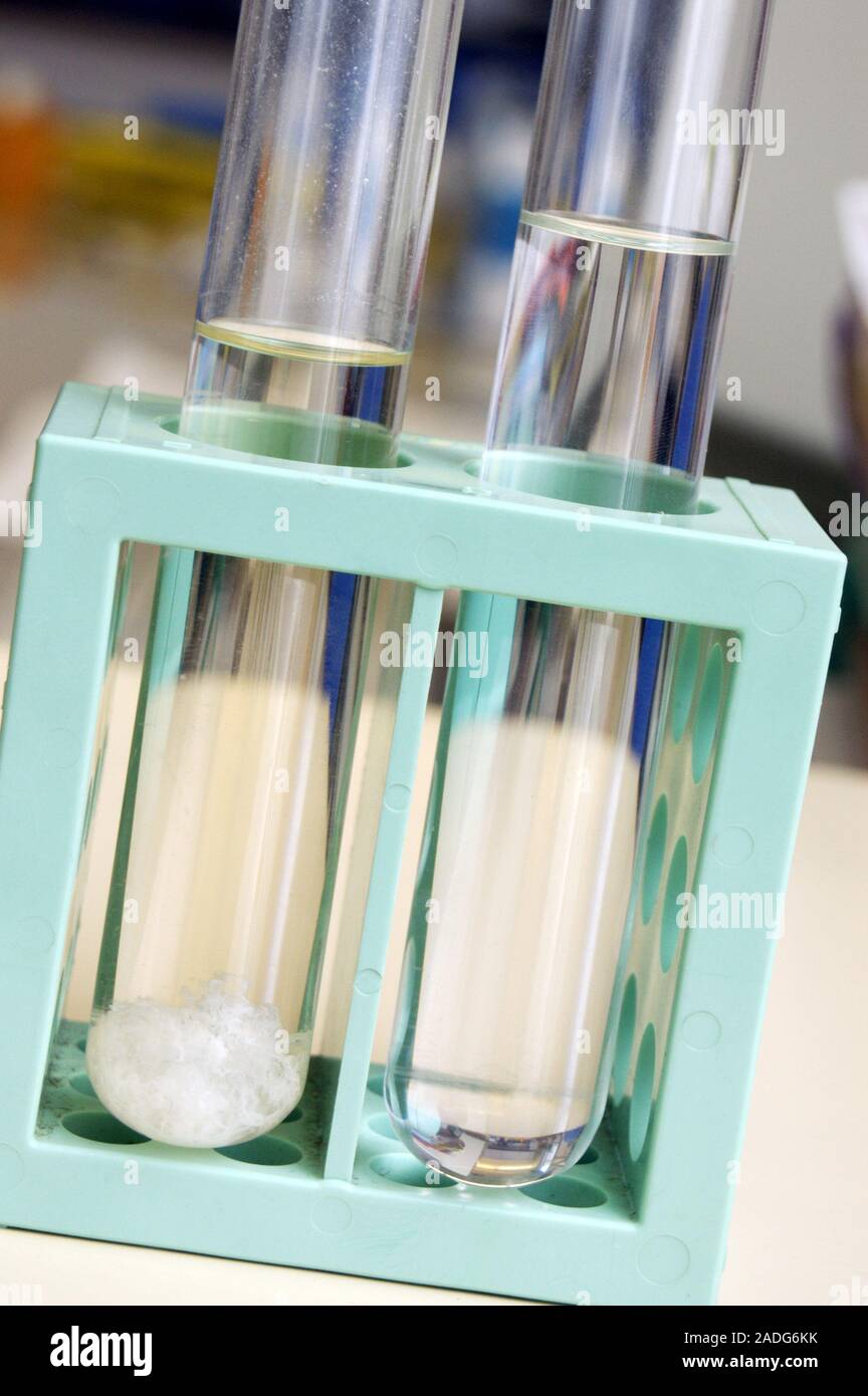DNA extraction. Image 9 of 10. Test tube containing a sample of human ...