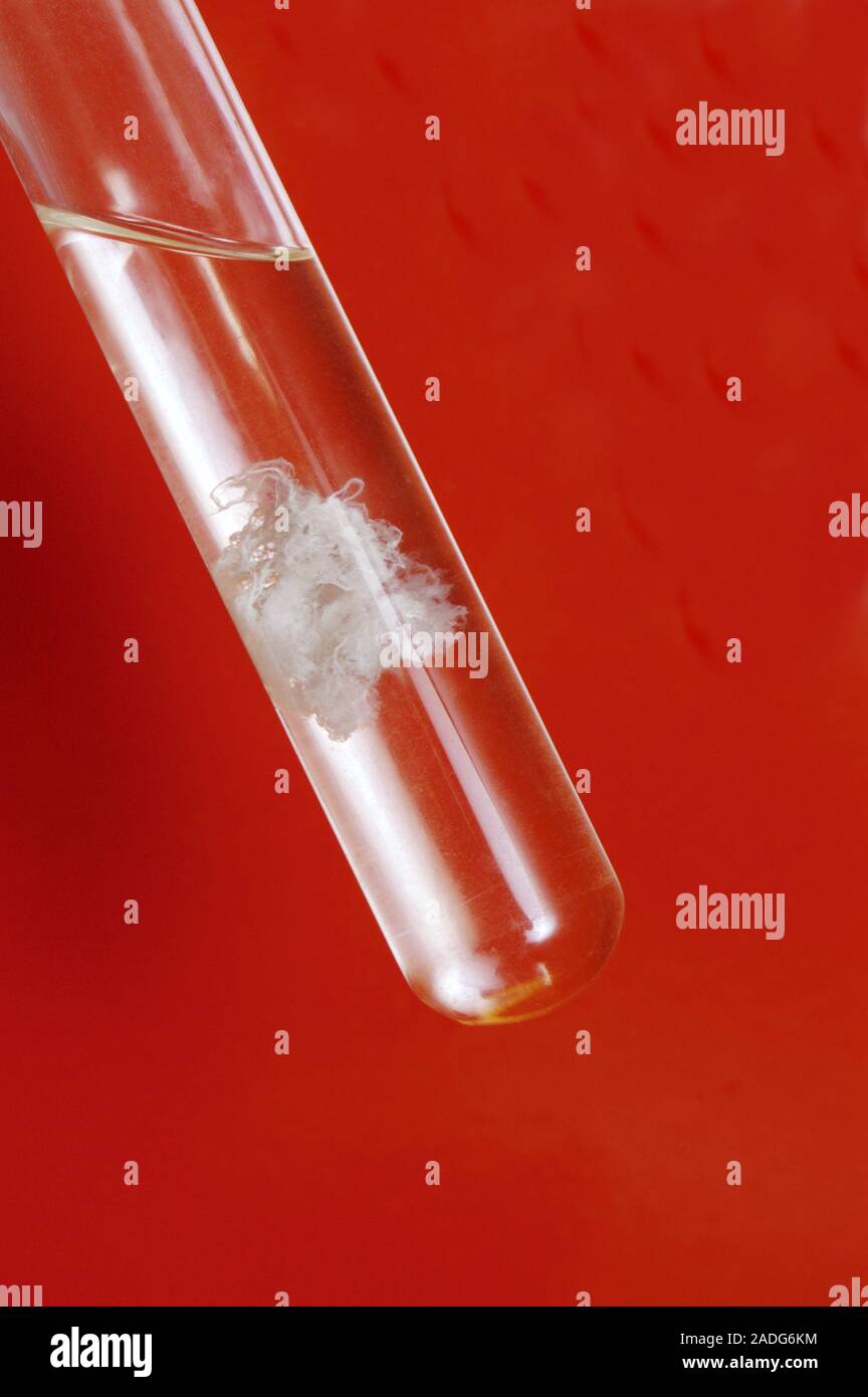 DNA extraction. Image 10 of 10. Test tube containing a sample of human ...