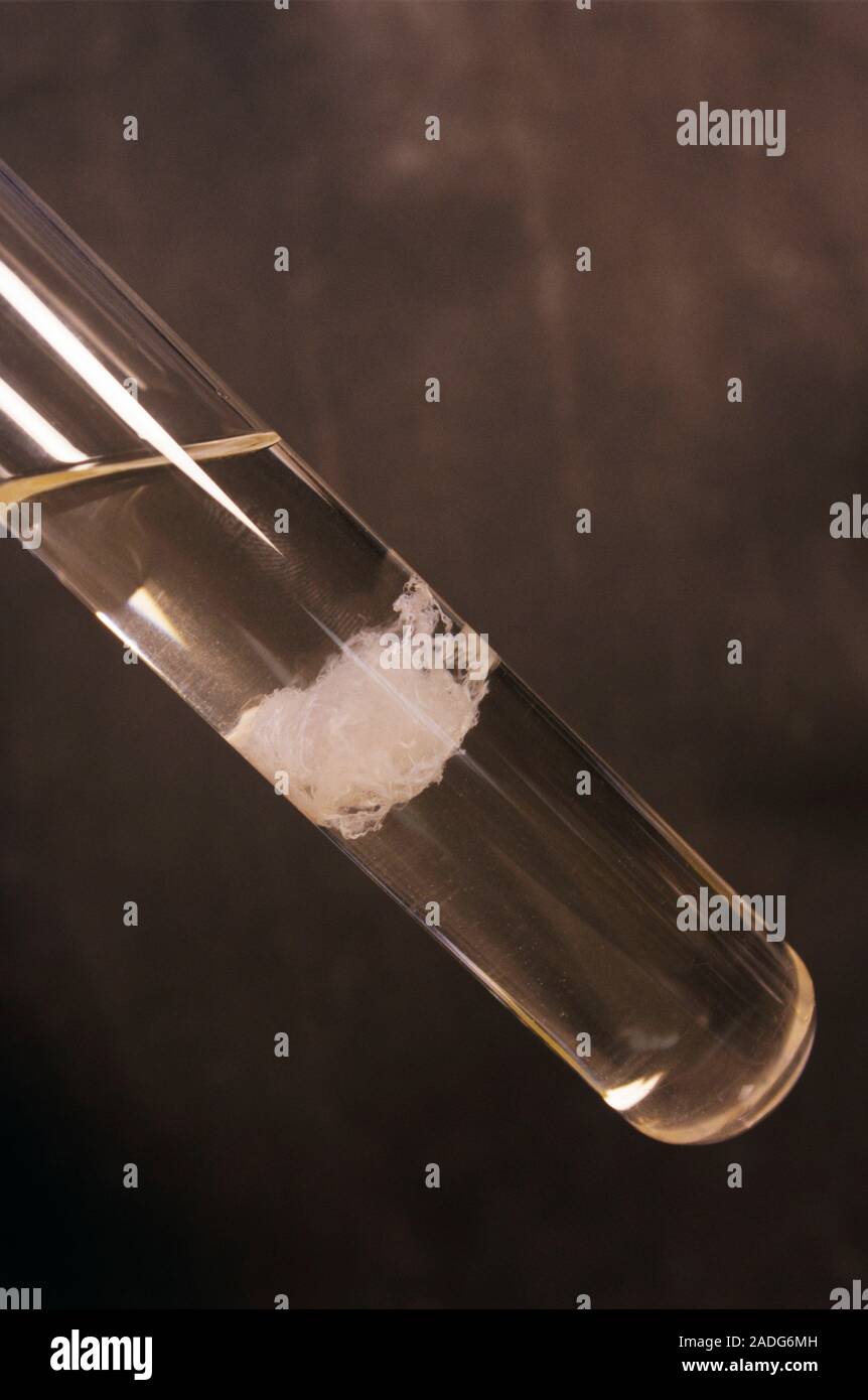 DNA precipitate (white) in a test tube. This is part of the stage for ...