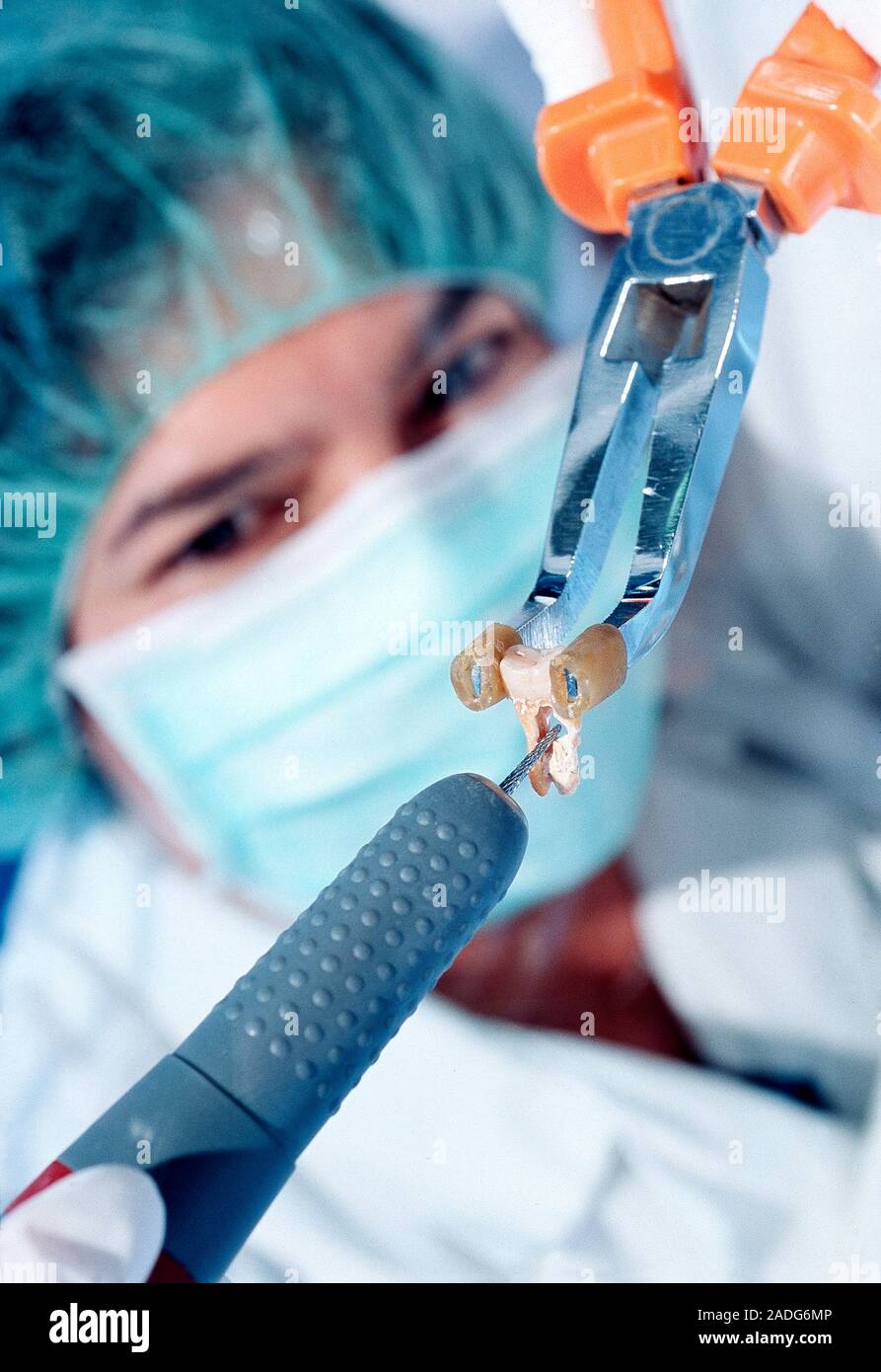 DNA extraction. Geneticist removing tissue from a tooth thought to ...